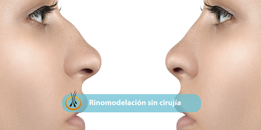 Rinomodelación Sin Cirujía en Benidorm, Alicante (Valencia) | Élite Capilar