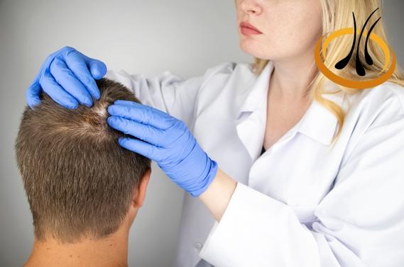 ¿Foliculitis decalvante, tiene tratamiento? | Élite Capilar | Clínica ...